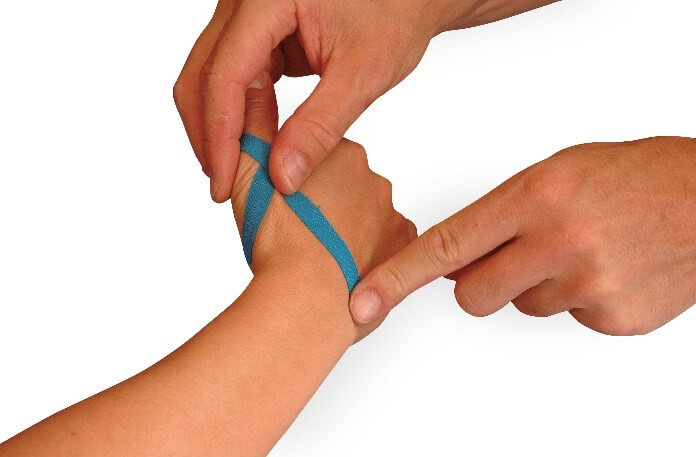 Skier's thumb – Kinesiology tape | THYSOL Australia